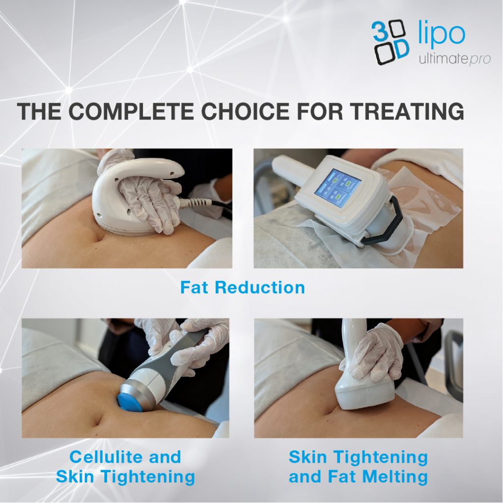 3D Lipo - Allure Laser Clinic